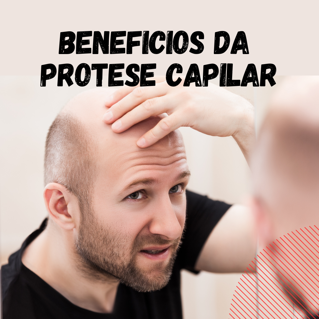Beneficios da Protese Capilar - Clayton Barber Shop
